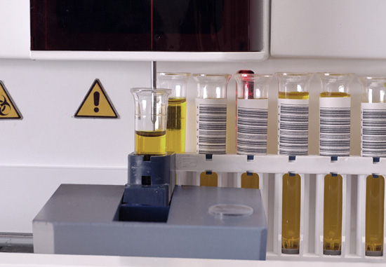 Dirui H-800 анализатор мочи автоматический